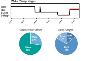 Watch-PAT 300 - SleepWorks Medical